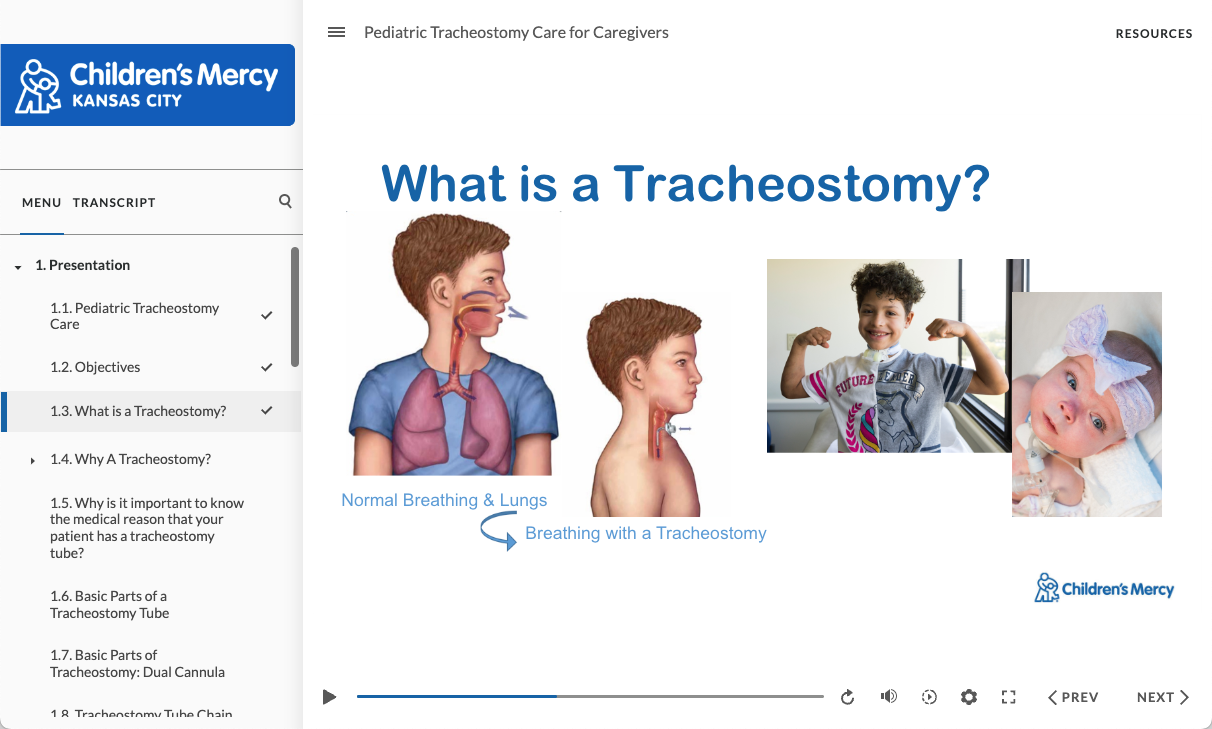 Pediatric Tracheostomy Care for Caregivers – Will Findlay