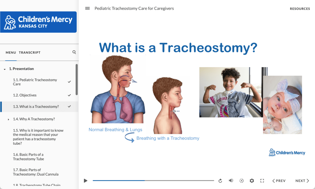 Pediatric Tracheostomy Care for Caregivers – Will Findlay